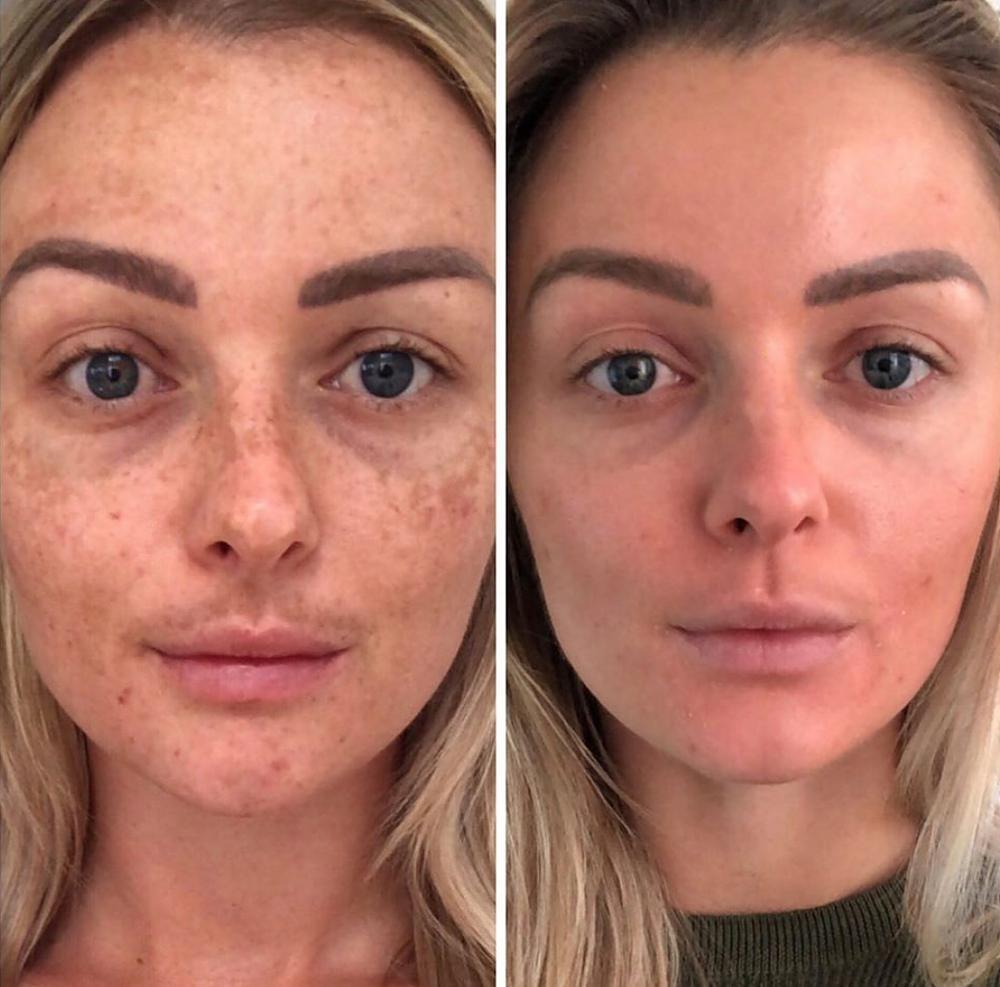 Specialist Skin & Laser Clinics | Laser & Cosmetic Clinics Specialist Skin & Laser Clinics | Laser & Cosmetic Clinics